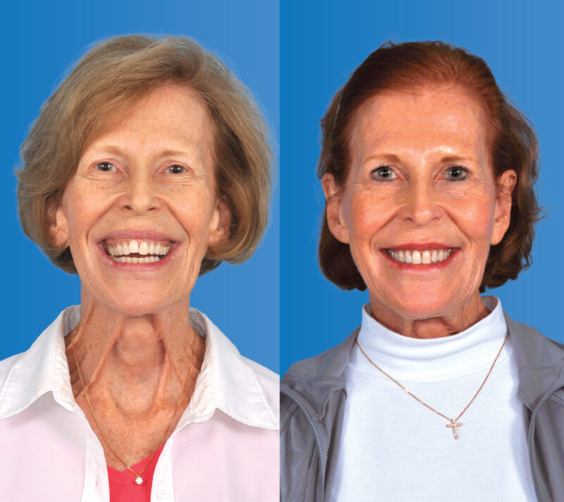 Oral Surgery Photo Gallery - DCOMS