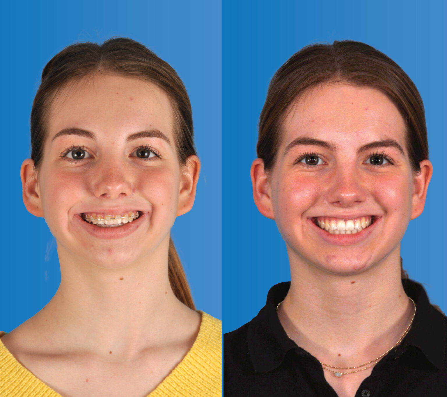 Oral Surgery Photo Gallery - DCOMS