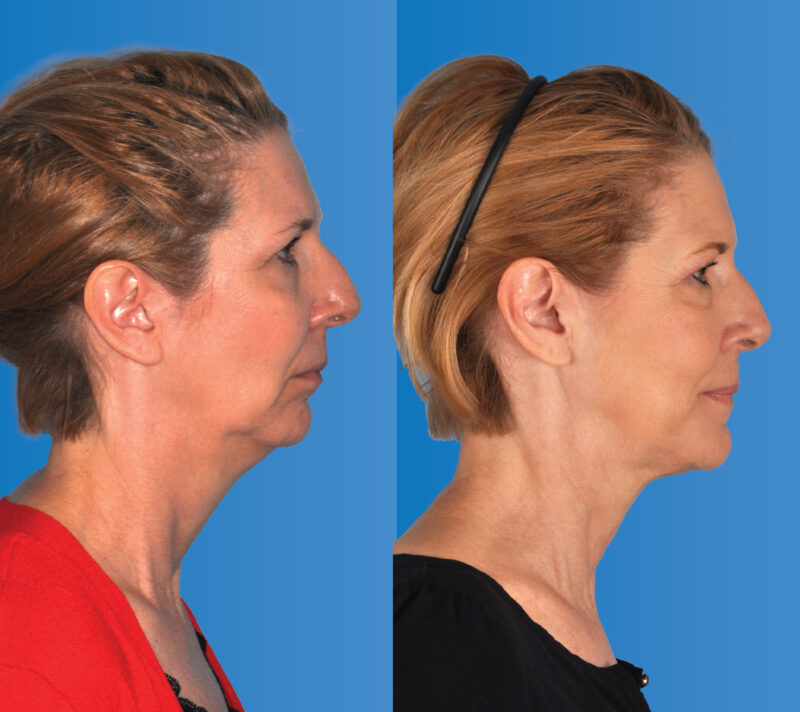 Oral Surgery Photo Gallery - DCOMS