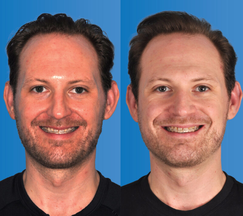 Oral Surgery Photo Gallery - DCOMS