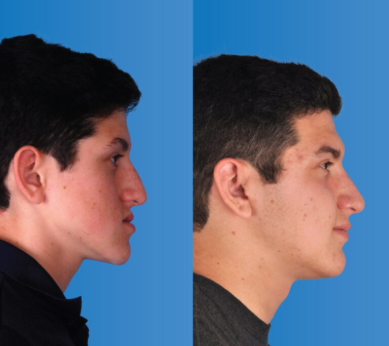 Oral Surgery Photo Gallery - DCOMS