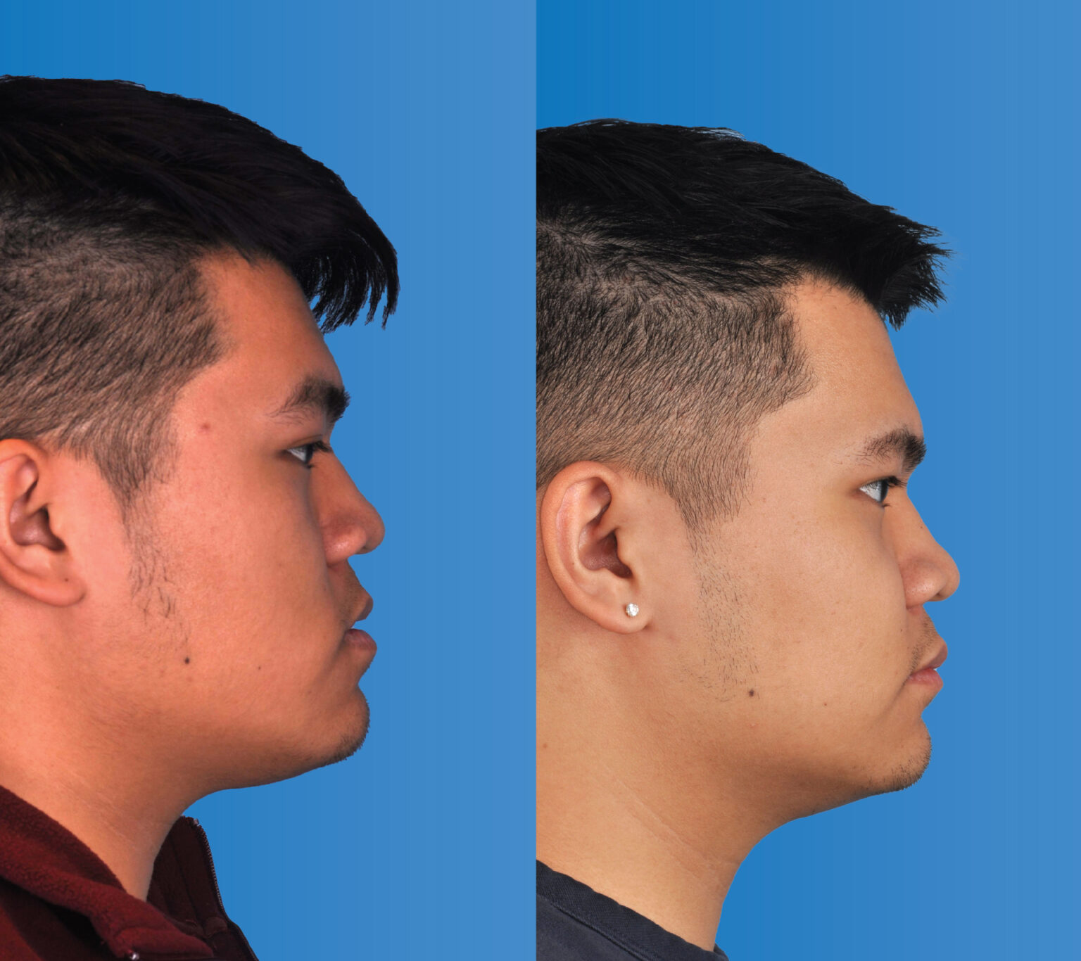 Oral Surgery Photo Gallery - DCOMS