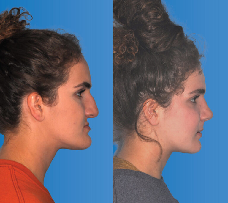 Oral Surgery Photo Gallery - DCOMS