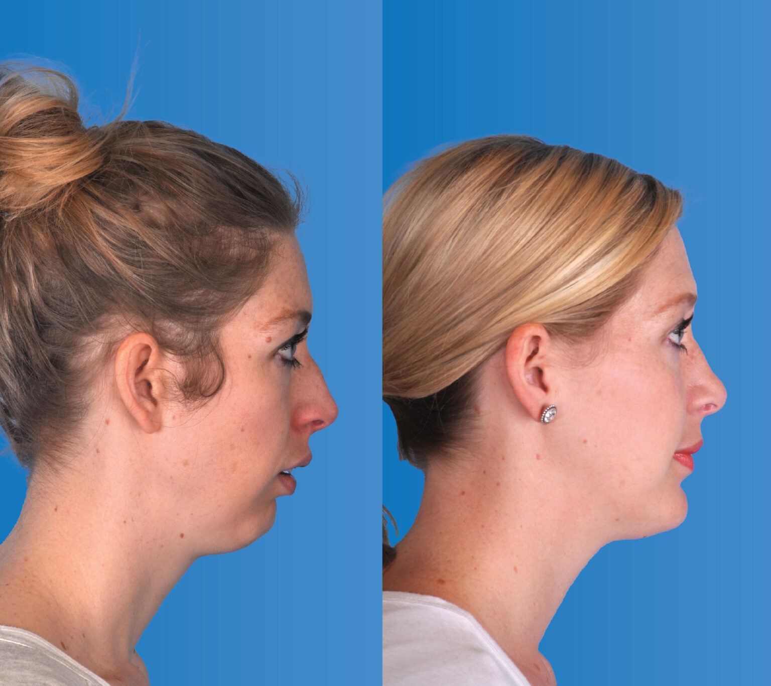 Oral Surgery Photo Gallery - DCOMS