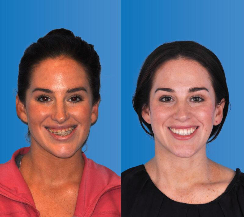 Oral Surgery Photo Gallery - DCOMS