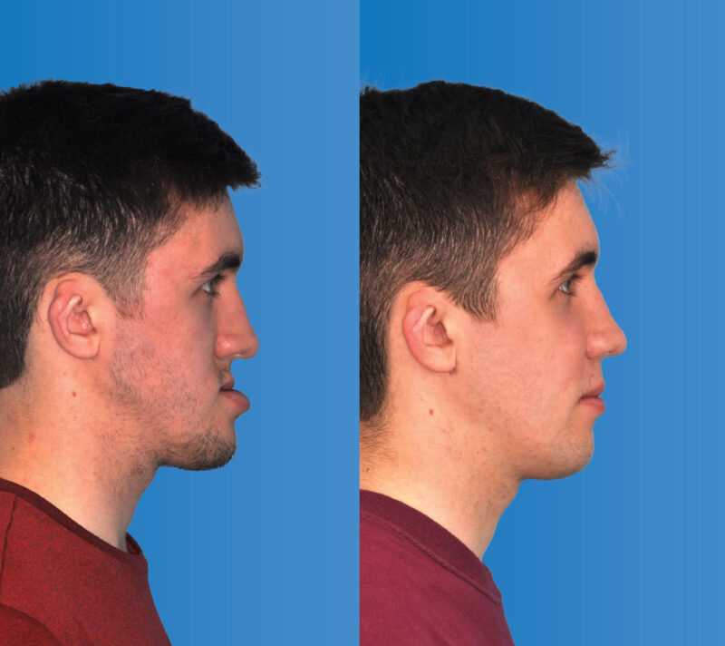 Oral Surgery Photo Gallery - DCOMS